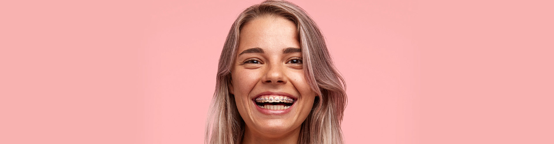 Why Do We Need Braces?